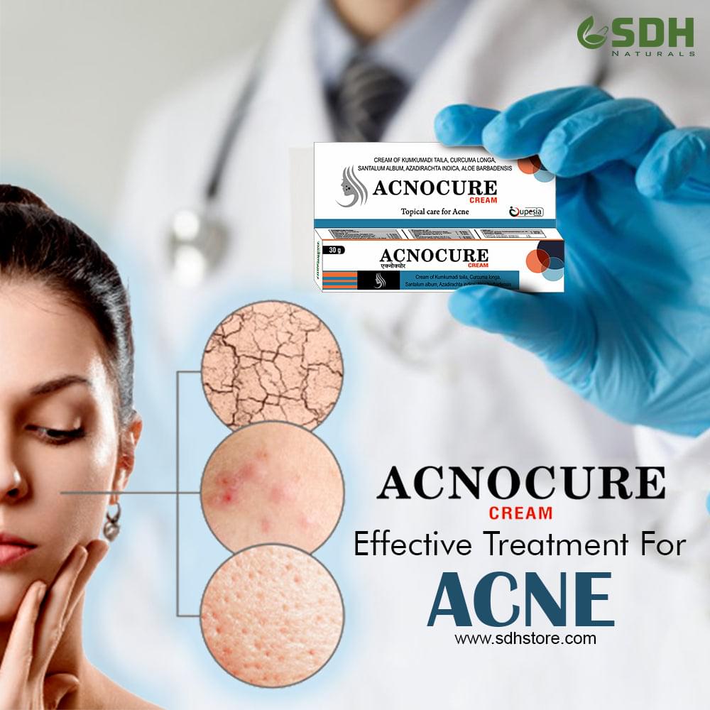 Buy Acnocure Cream Online | Cream for Skin Health – SDH Naturals